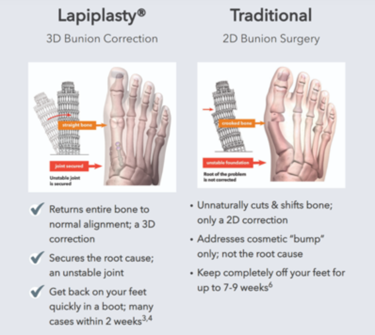 Bunion Surgery Lapiplasty®: Learn All About The New Breakthrough